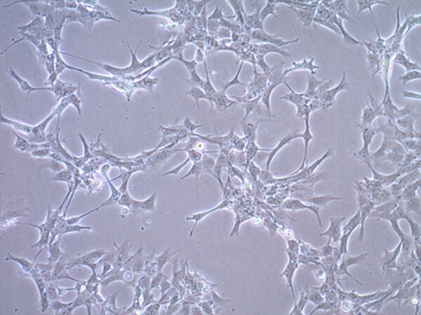GT1-7 Mouse Hypothalamic GnRH Neuronal Cell Line | SCC116